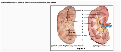 Solved Use Figure 1 To Identify Where The Medulla Osmolarity