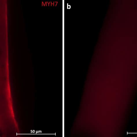 Single Muslce Fiber Fibertyping A A Representative Image Of A Single Download Scientific