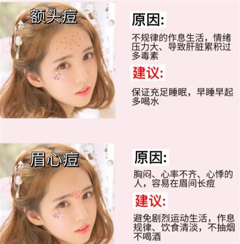 祛痘印的大三妙招？其中一个居然还是我们常常忽略的 知乎