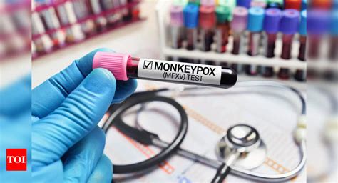 Monkeypox African Woman Delhi S 6th Monkeypox Case Delhi News