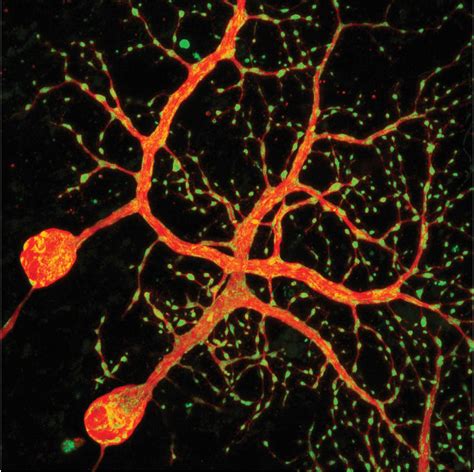 Research Mitochondrial Physiology Laboratory Bascom Palmer Eye Institute University Of