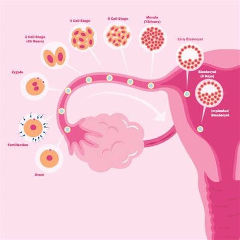 Ovarian Cancer Illustrations Royalty Free Vector Graphics And Clip Art