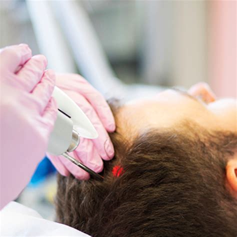 Laser Lllt Low Light Laser Therapy Dra Andressa Sato Dermatologista