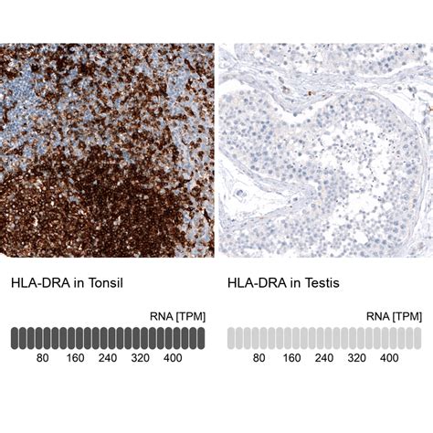 Mouse Monoclonal Anti Hla Dra Antibody Buy For Research Highly