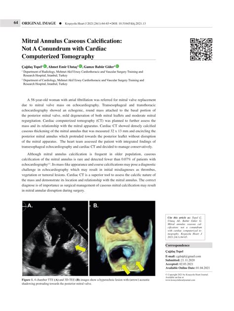 Pdf Mitral Annulus Caseous Calcification Not A Conundrum With