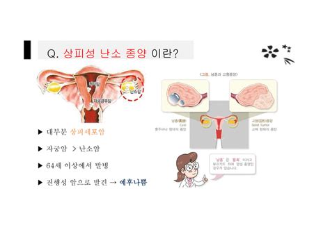 간호학 상피성 난소의 종양 의약학