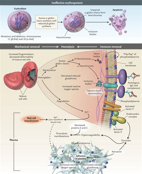 β Thalasemia
