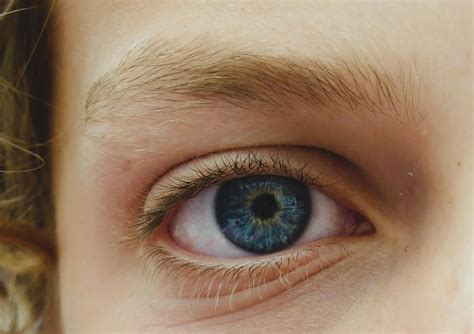 Blefarite Anterior Vs Posterior