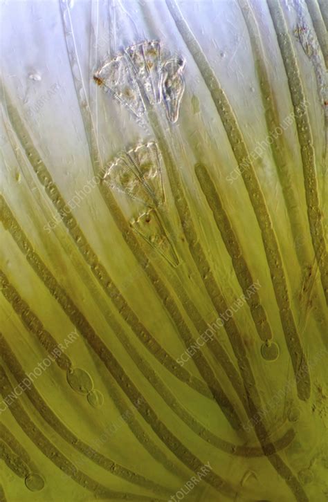 Cyanobacteria And Diatoms Light Micrograph Stock Image C0560397