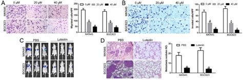 Luteolin Suppressed Gc Cell Migration And Invasion In Vitro And In