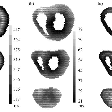 Action Potential Duration A Excitation B And Repolarization C