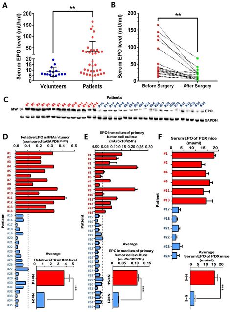 Elevated Serum Erythropoietin Epo Was Associated With Tumor Load In A Download Scientific