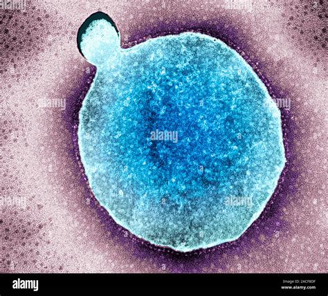 Mycoplasma Sp Bacteria Coloured Transmission Electron Micrograph Tem