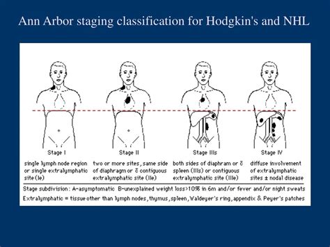 Ppt Lymphoma Powerpoint Presentation Free Download Id9591183