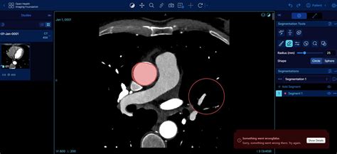 Export Dicom Seg From Ohif Gives Error General Orthanc Users