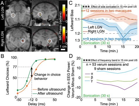 Noninvasive Sustained And Reversible Modulation Of Deep Brain Download Scientific Diagram