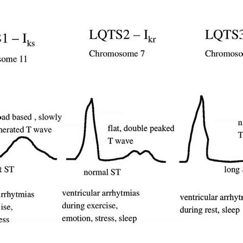 Abnormal Types Of T Waves In Lqts Lqts1 Lqts2 Lqts3 Download