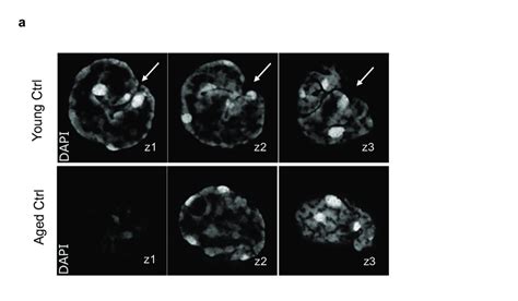 Figure S4 Nuclear Volume And Nuclear Shape Are Altered Upon Aging Of