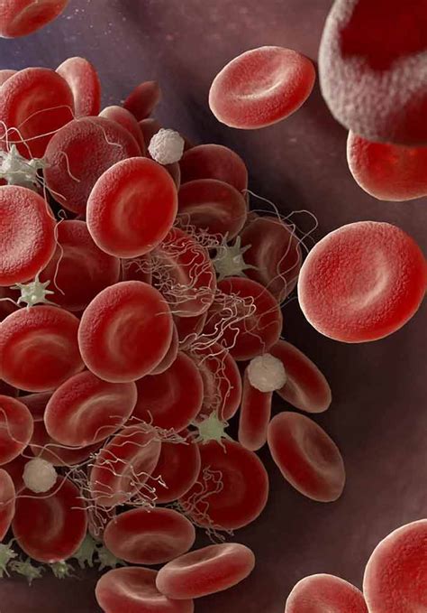 Thrombocytopenia In Neonates Intechopen