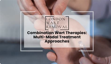 Do Warts Ever Go Away Without Treatment London Wart Removal Clinic