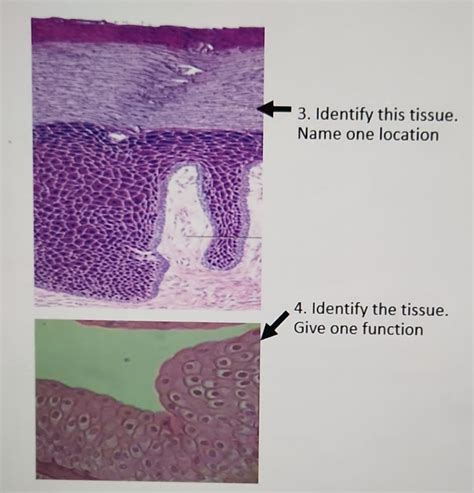 Solved 7 Identify This Tissue Give One Location 8