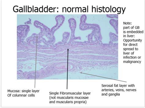 Pathology Gallbladder Extrahepatic Biliary Tract And Pancreas Flashcards Quizlet