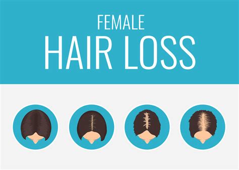 Difference Between Male And Female Pattern Hair Loss Terra Medical