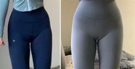 Hip Dip Filler Storyfinding The Perfect Balance For Your Hips