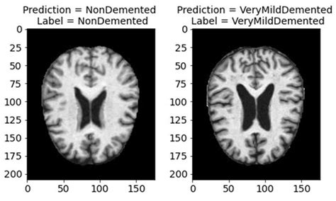 Sample Predictions Of The Customised Model Download Scientific Diagram