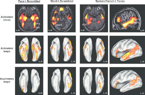 Activation And Hemispheric Asymmetries During Written Words Faces And