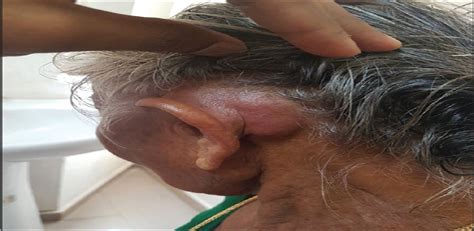 Indian Journal Of Otology