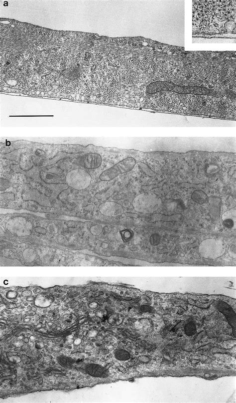 Ultrastructural Demonstration Of The Effect Of Pcbs On L6 Cells