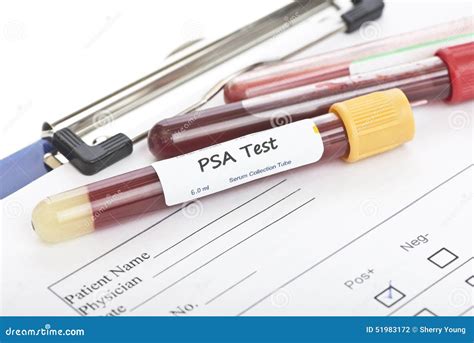 PSA Test Stock Photo Image Of Background Culture Laboratory 51983172