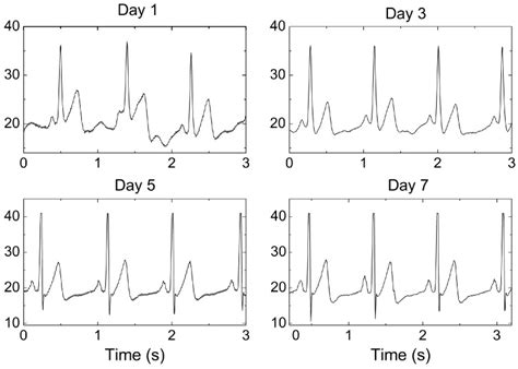 Flexible Graphene Electrodes For Prolonged Dynamic Ecg Monitoring