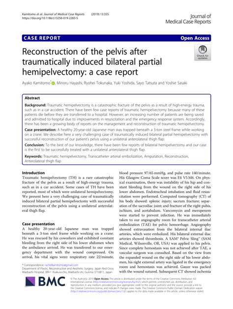 Pdf Reconstruction Of The Pelvis After Traumatically Induced