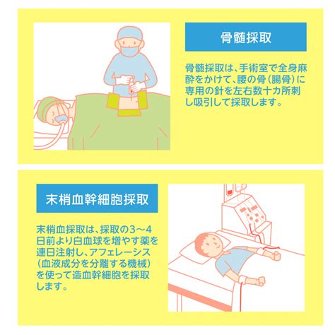 骨髄提供までの流れ Start To Be