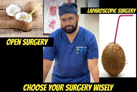 Perumalla Karthik Babu On Linkedin Opensurgery Laparotomy Laparoscopicsurgery
