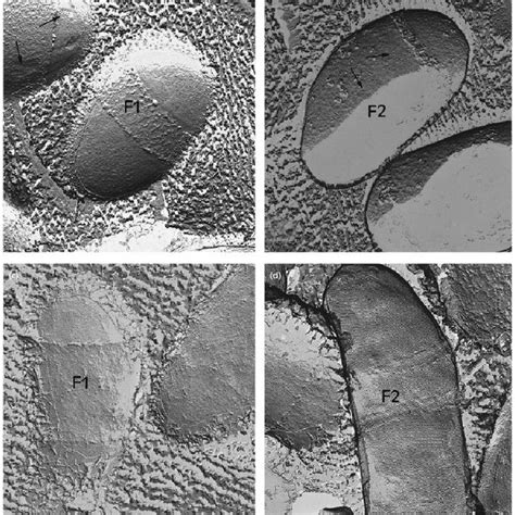 Electron Micrograph Of A Freeze Fracture And Deep Etched Preparation Of
