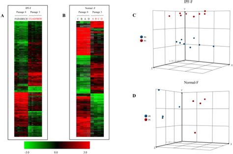 Global Gene Expression Analysis In An In Vitro Fibroblast Model Of Idiopathic Pulmonary Fibrosis
