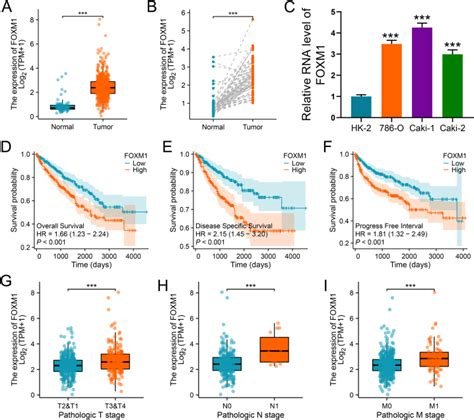 Foxm1kif20a Axis Promotes Clear Cell Renal Cell Carcinoma Progression