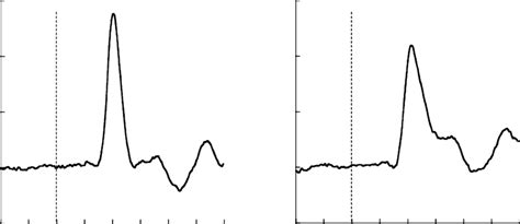 Grand Averaged Waveforms Of Veps In Response To Chromatic Stimuli At Download Scientific