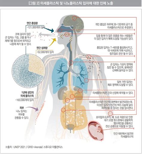 인쇄하기