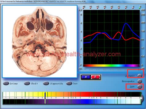 D Cell Nls Software Here S A Quick Way To Know It
