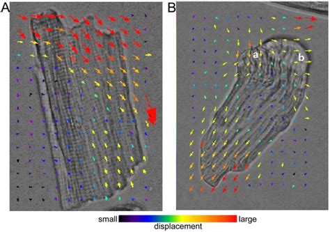 Contractile Image Analysis Of The Cardiomyocyte Components Movements