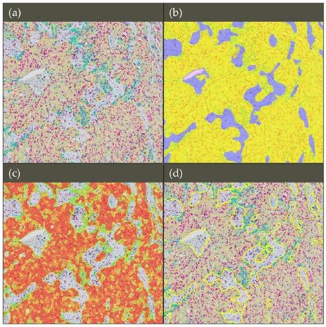 Tissue Classification Using The Random Forest Classifier In Non Small