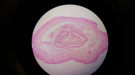 Bio 112 Lab Quiz 8 Invertebrate Diversity Flashcards Quizlet