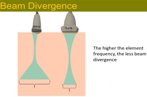 Transducer Structure CH Flashcards Quizlet