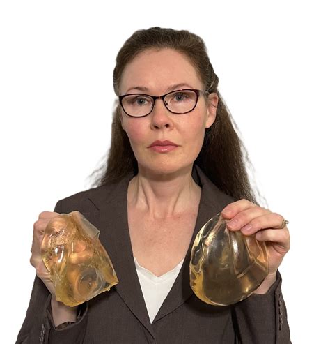 Blog 2 — Breast Implant Research