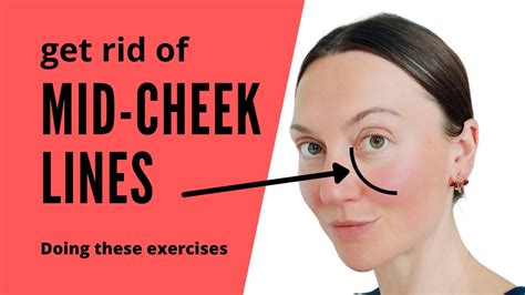 Mid Cheek Lines Face Yoga Exercises Reasons Solution To Reduce And