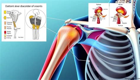 Shoulder Sos Decoding Rotator Cuff Injuries For Lasting Relief
